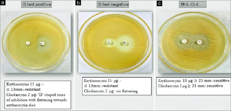 Antimicrobial Resistance - Digital PharmD by GoPharmD